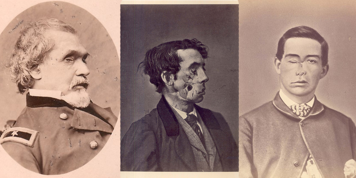 Eye Injuries in the Civil War with Mark Breazzano, MD - National Museum ...