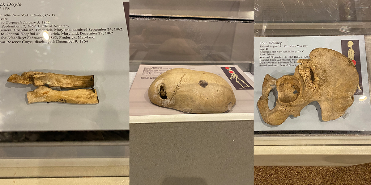 On Tour - Medical Specimens from the Maryland Campaign - National ...